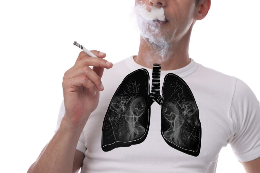 La Enfermedad Pulmonar Obstructiva Crónica (EPOC) - MGC Mutua