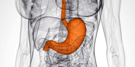 Problemas digestivos más comunes - MGC Mutua